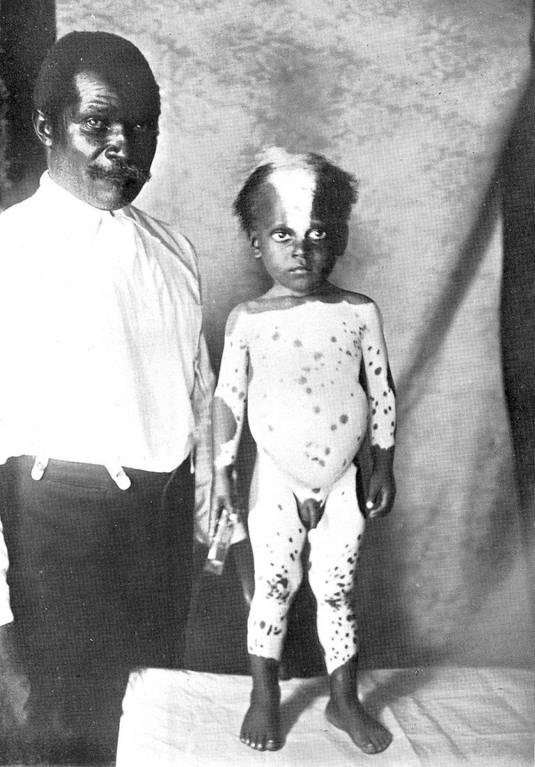 KIT – embryonic lethality – Principles of Biology