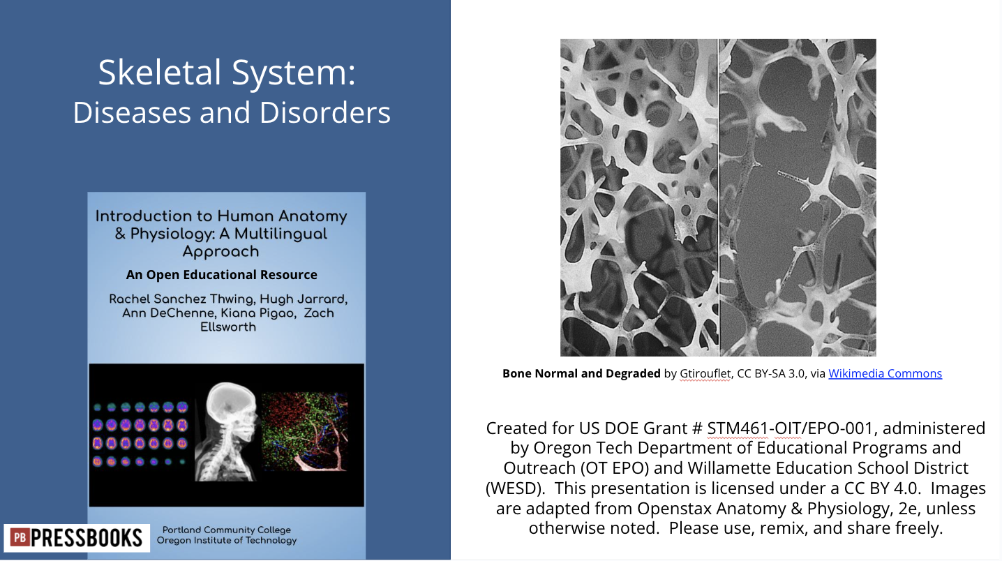 Lesson 4: Homeostatic Imbalances of the Skeletal System – Introduction ...