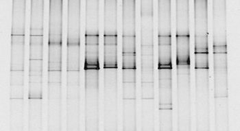 Gel Electrophoresis and DNA Fingerprinting – MHCC Biology 112: Biology ...